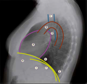 Metodologia dell’interpretazione di una radiografia del torace – Bald ...