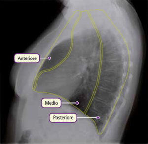 Metodologia dell’interpretazione di una radiografia del torace – Bald ...