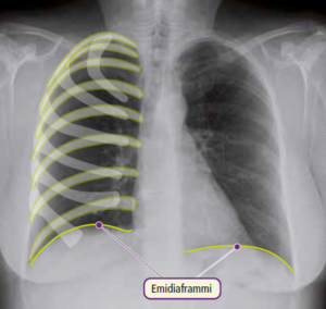 Metodologia dell’interpretazione di una radiografia del torace – Bald ...